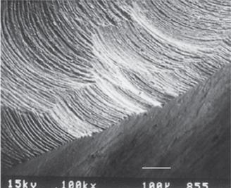 7: Principles of Tooth Preparation