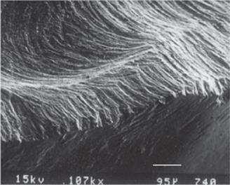 7: Principles of Tooth Preparation