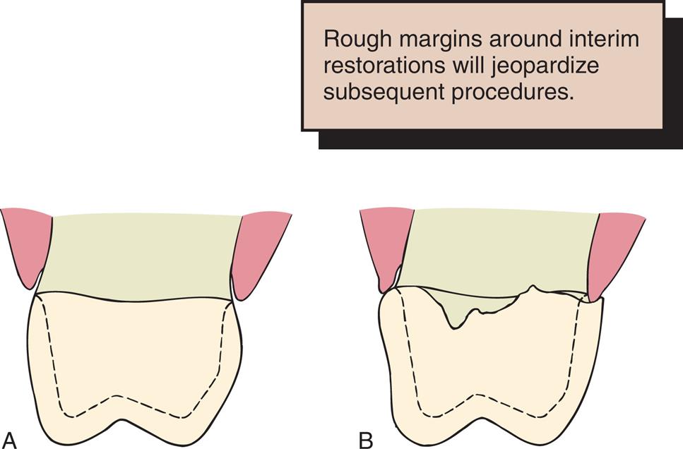 15: Interim Fixed Restorations