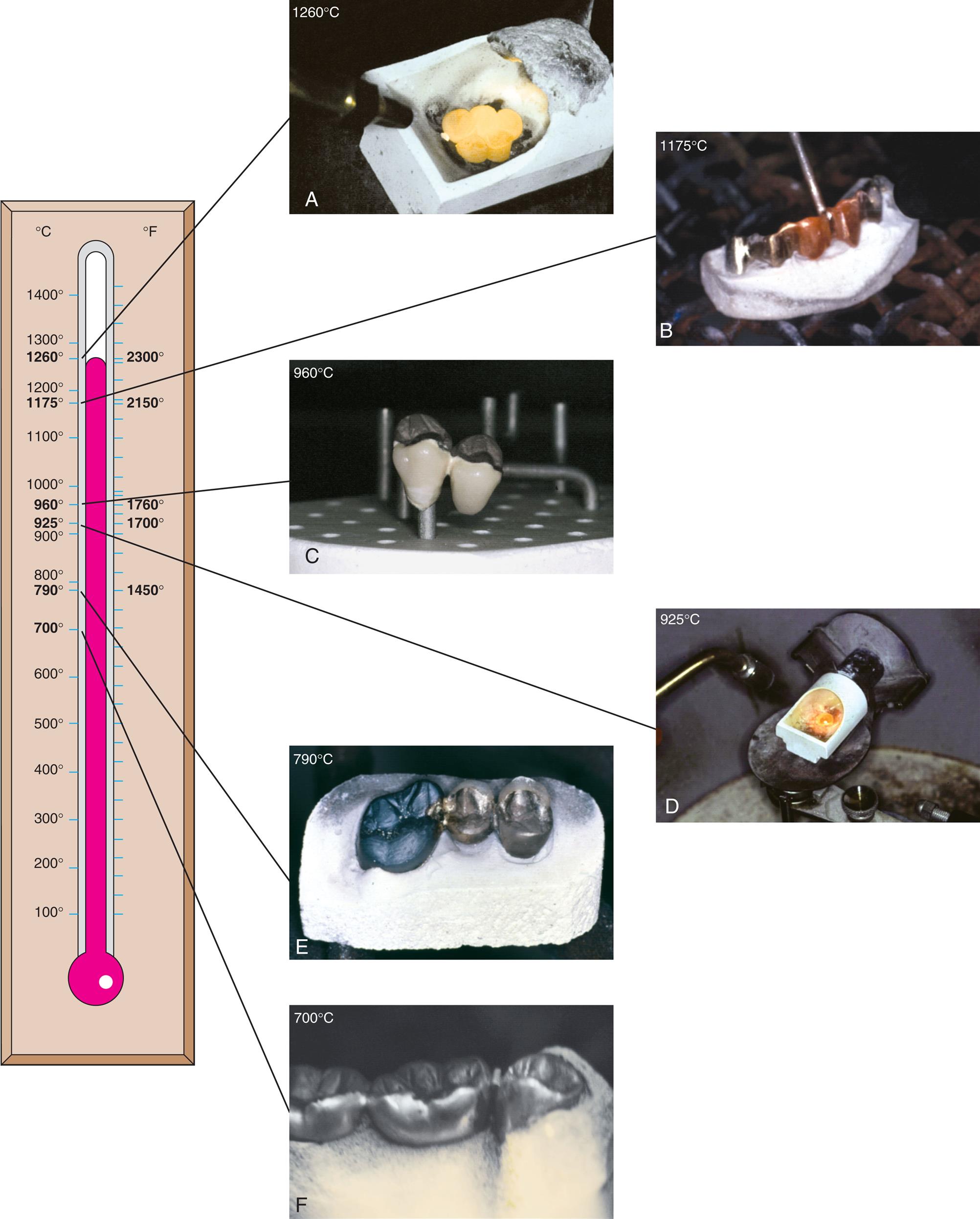 27: Connectors for Fixed Partial Dentures