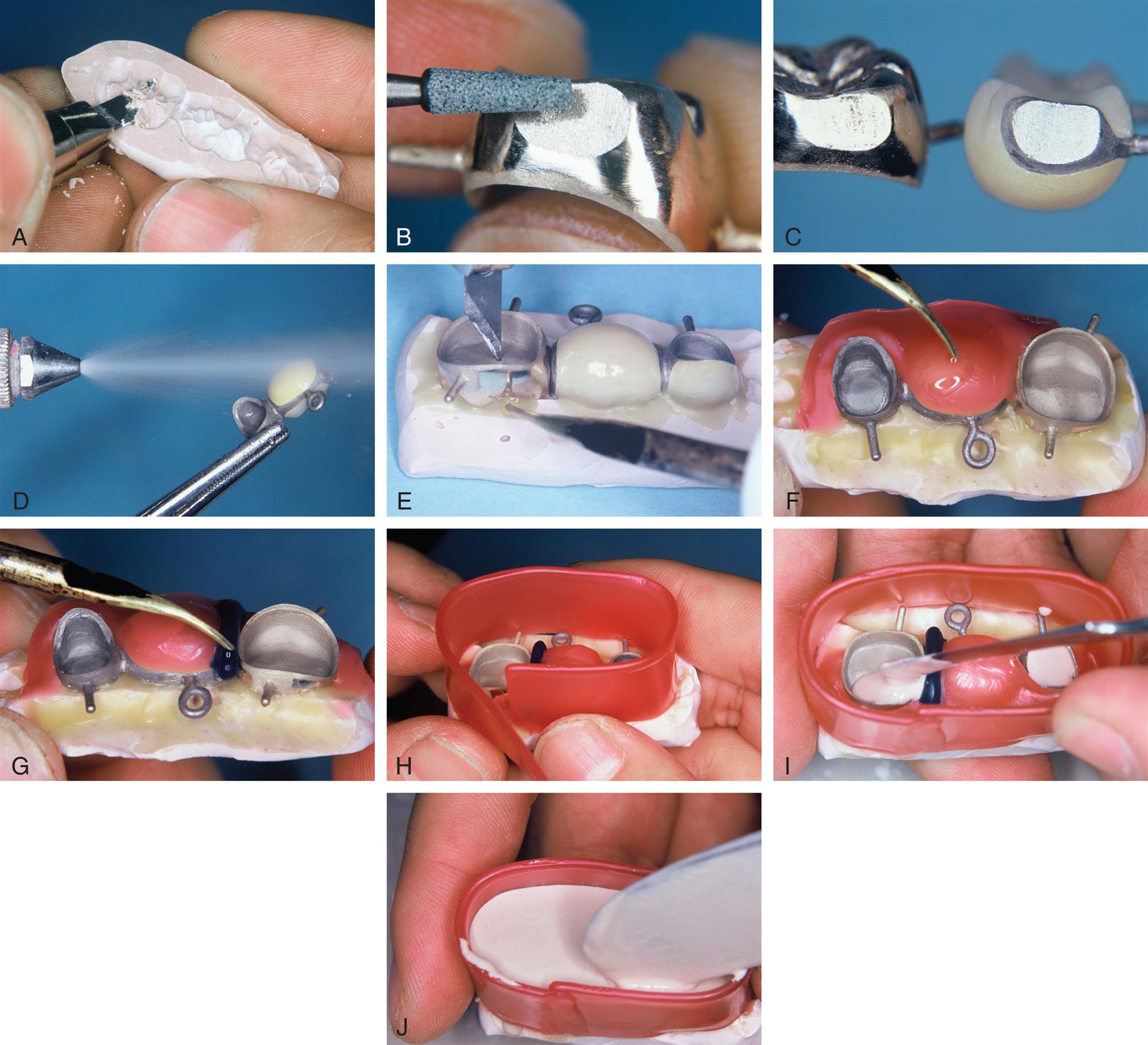 27: Connectors for Fixed Partial Dentures