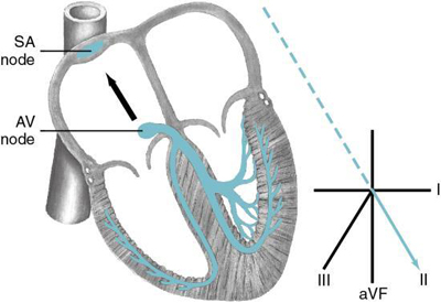 Junctional rhythms