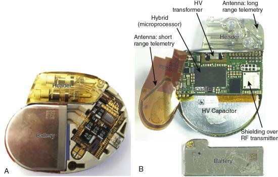 Pacemaker rhythms