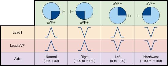 Introduction to the 12-lead ECG