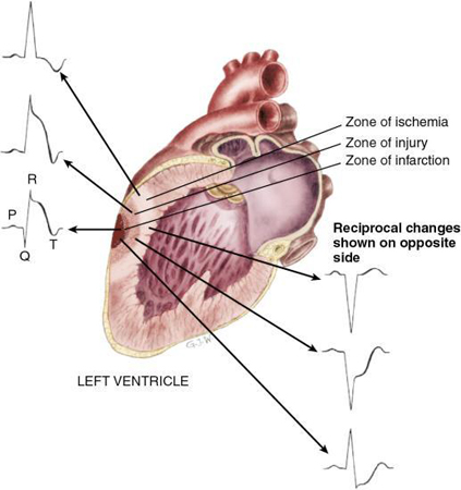 Introduction to the 12-lead ECG