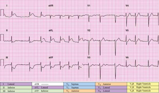Introduction to the 12-lead ECG