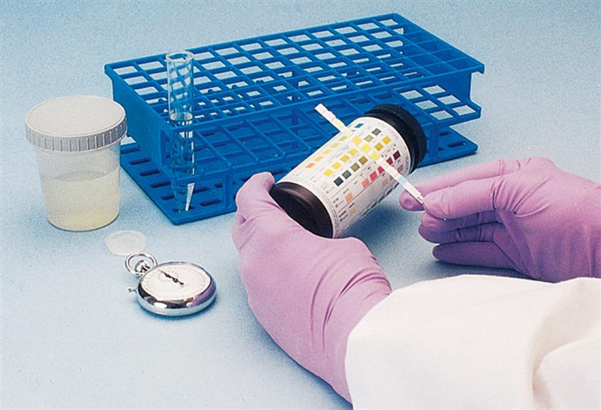 6: Routine Urinalysis—the Chemical Examination
