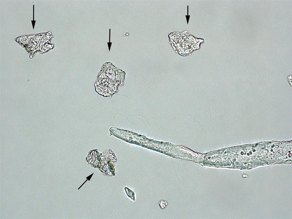 Urine Sediment Image Gallery