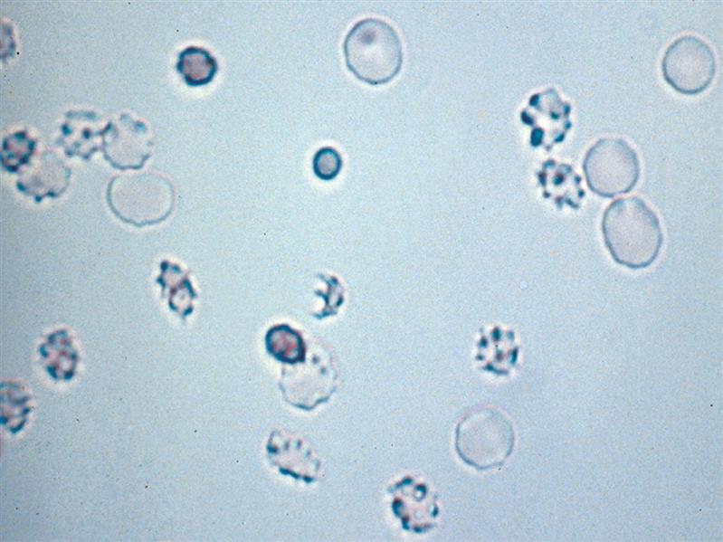 Urine Sediment Image Gallery