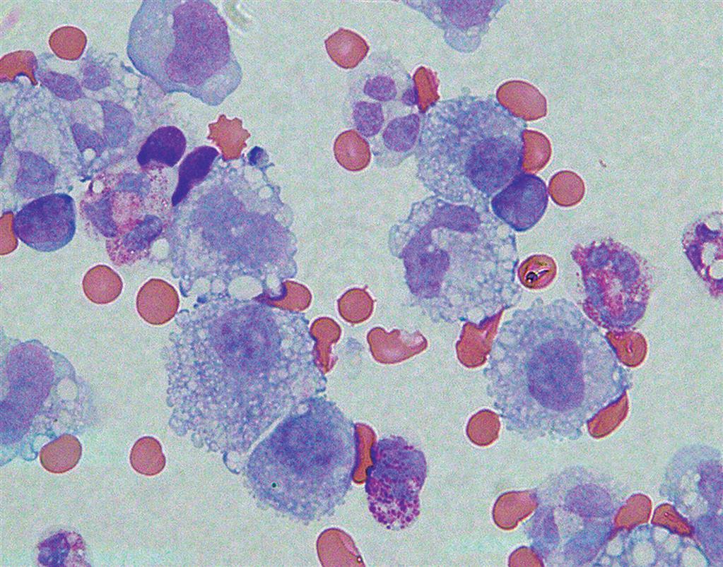 Urine Sediment Image Gallery