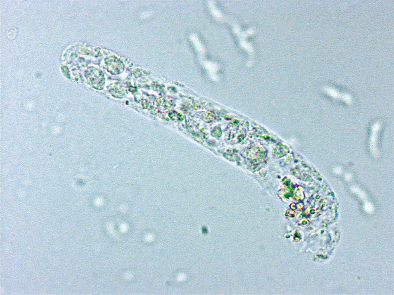 Urine Sediment Image Gallery