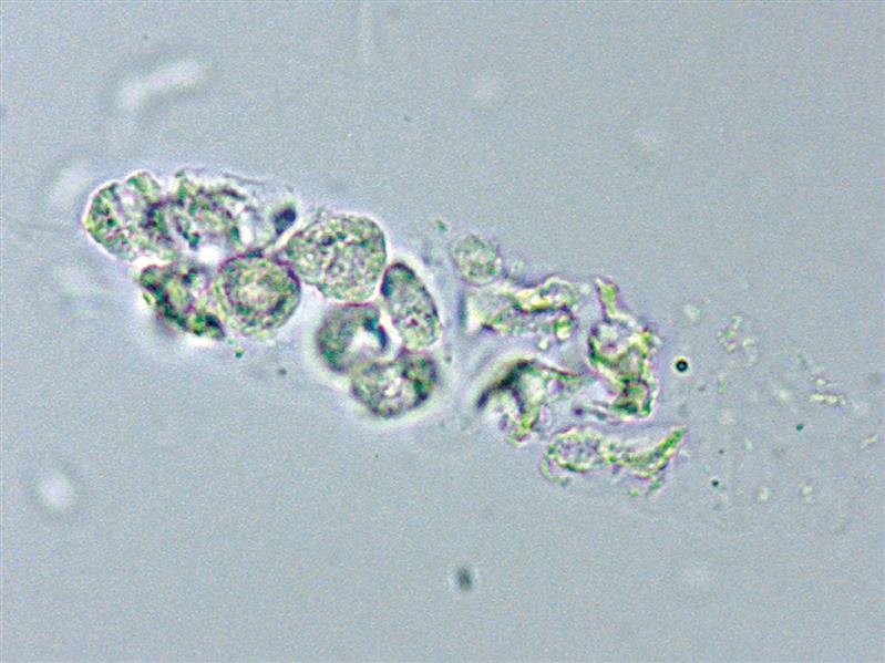 Urine Sediment Image Gallery