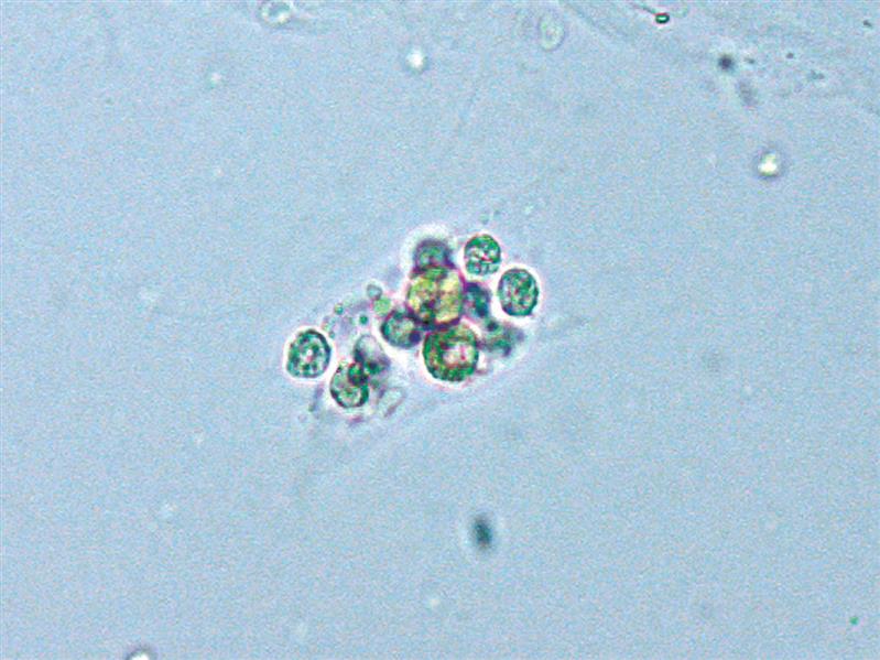 Urine Sediment Image Gallery