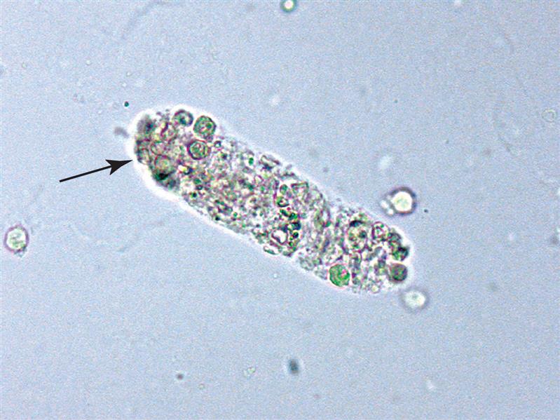 Urine Sediment Image Gallery