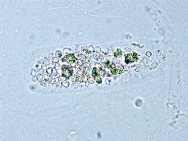 Urine Sediment Image Gallery