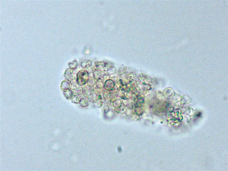 Urine Sediment Image Gallery