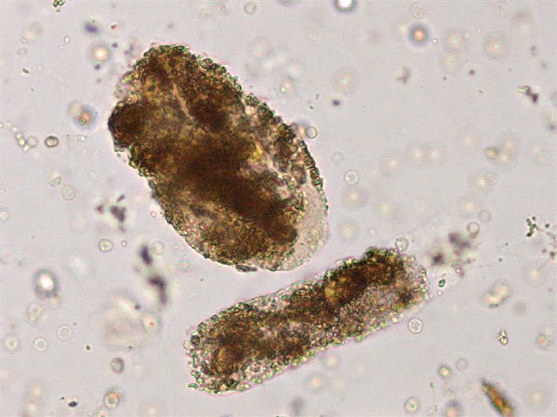 Urine Sediment Image Gallery