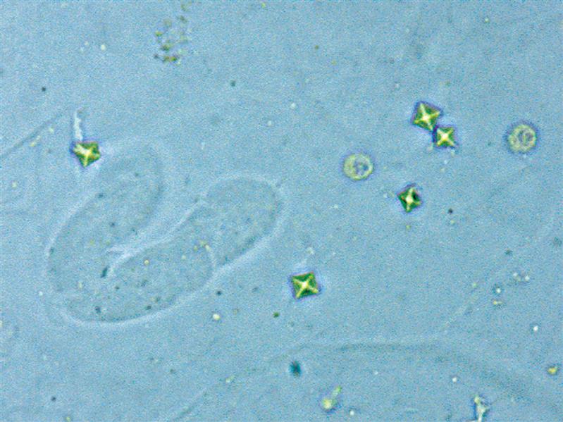 Urine Sediment Image Gallery