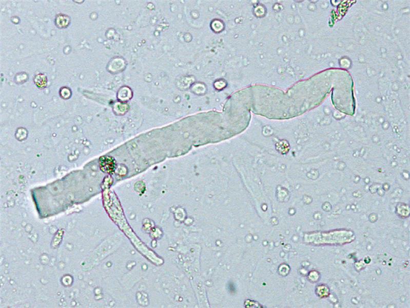 Urine Sediment Image Gallery