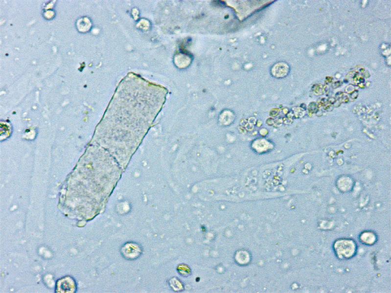 Urine Sediment Image Gallery