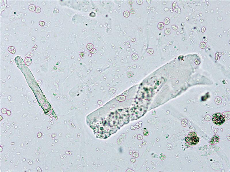 Urine Sediment Image Gallery