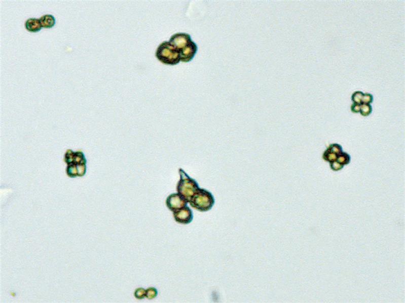 Urine Sediment Image Gallery
