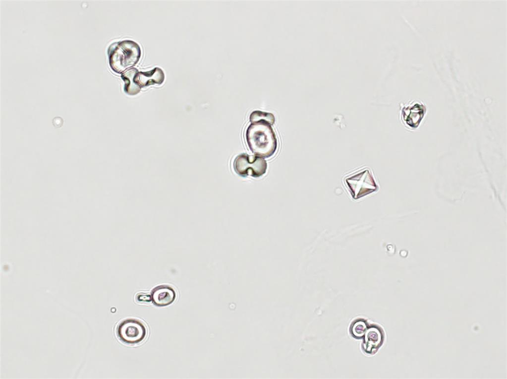 Urine Sediment Image Gallery