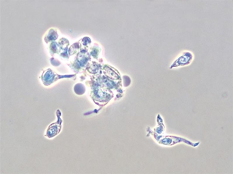 Urine Sediment Image Gallery