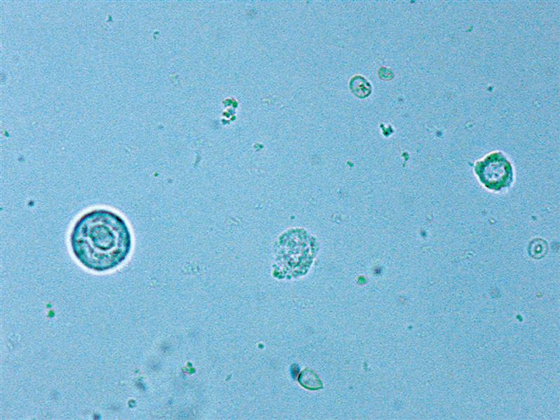 Urine Sediment Image Gallery