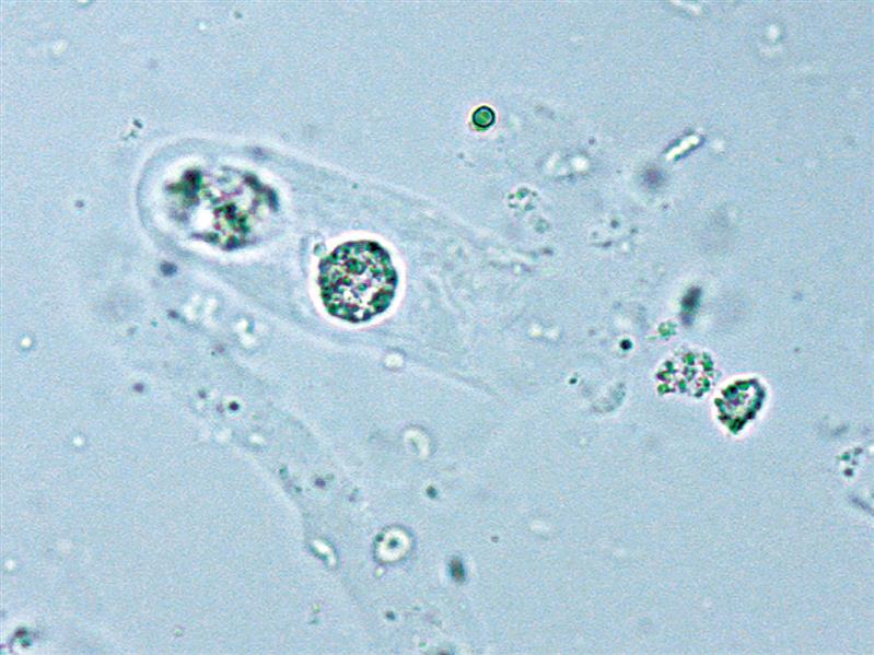 Urine Sediment Image Gallery