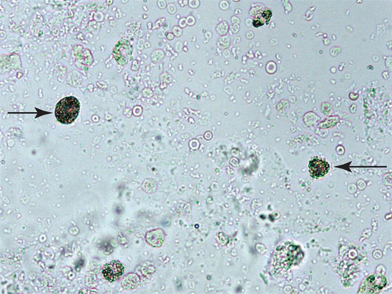 Urine Sediment Image Gallery