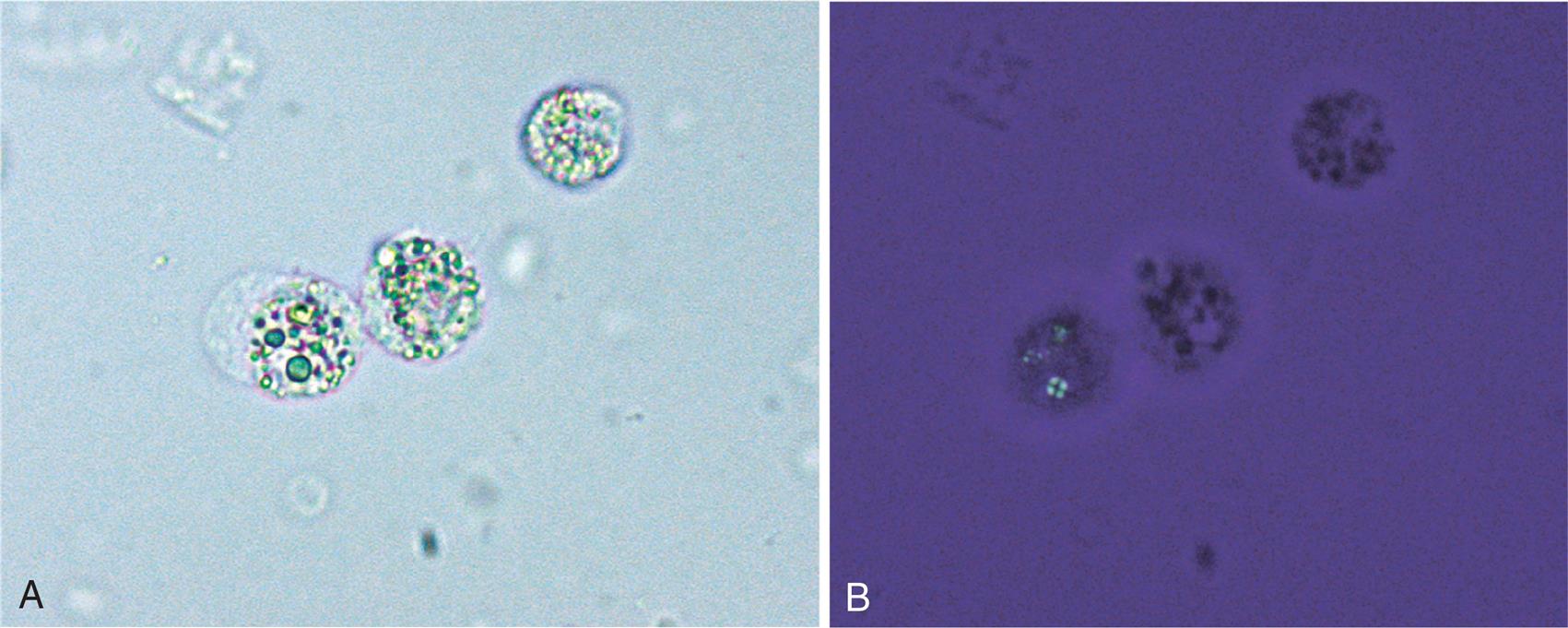Urine Sediment Image Gallery