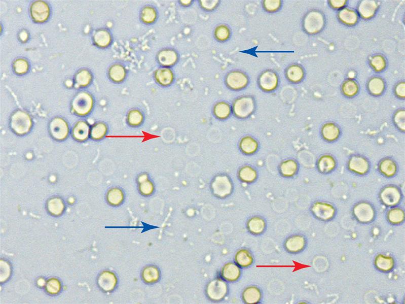 Urine Sediment Image Gallery