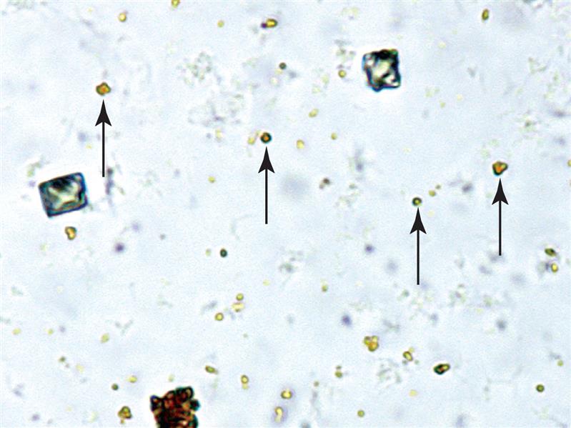 Urine Sediment Image Gallery