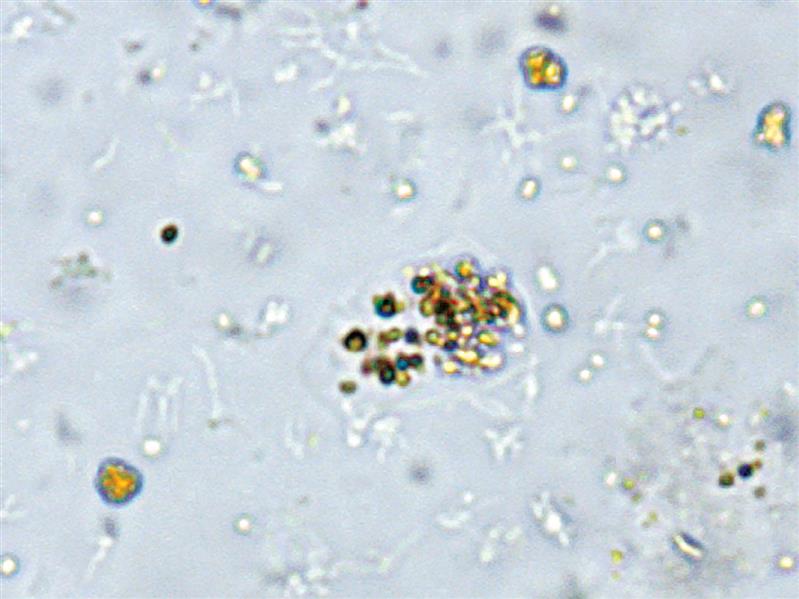 Urine Sediment Image Gallery
