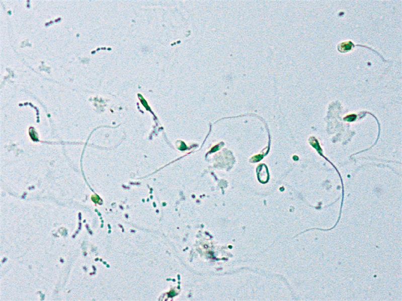 Urine Sediment Image Gallery