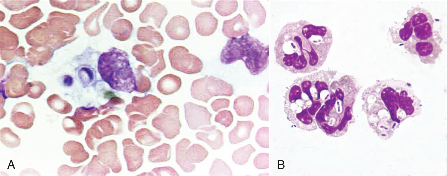 9: Cerebrospinal Fluid Analysis