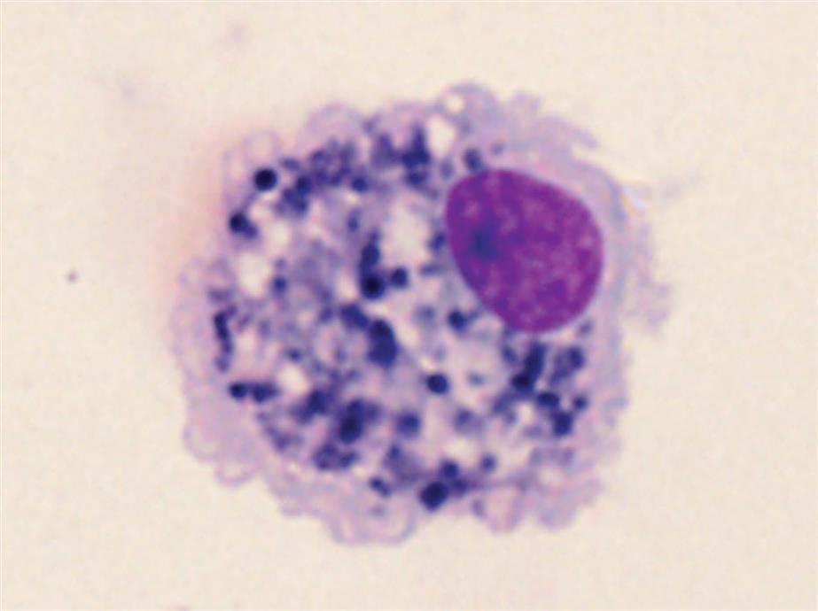 9: Cerebrospinal Fluid Analysis