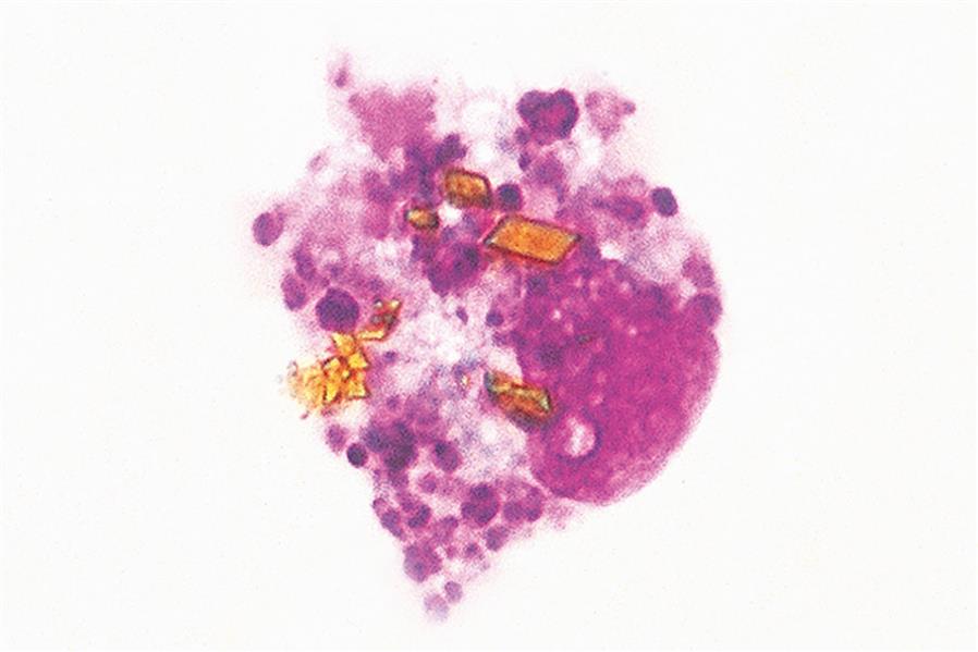 9: Cerebrospinal Fluid Analysis