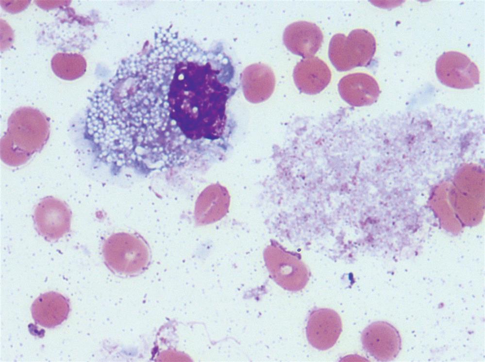 9: Cerebrospinal Fluid Analysis