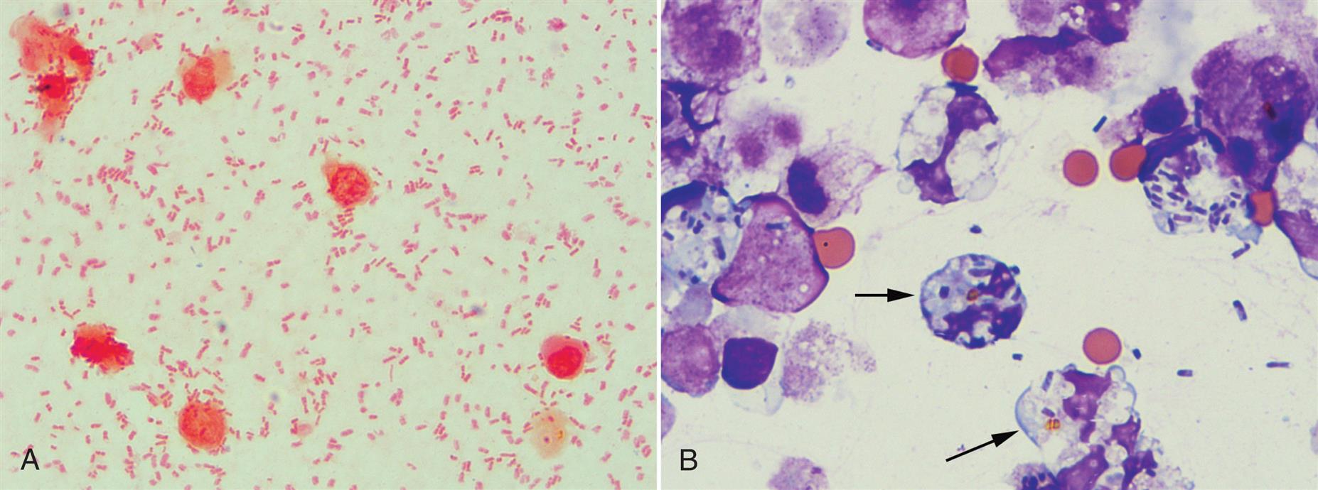 9: Cerebrospinal Fluid Analysis