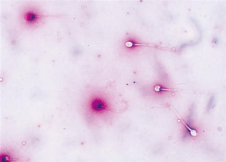 12: Seminal Fluid Analysis