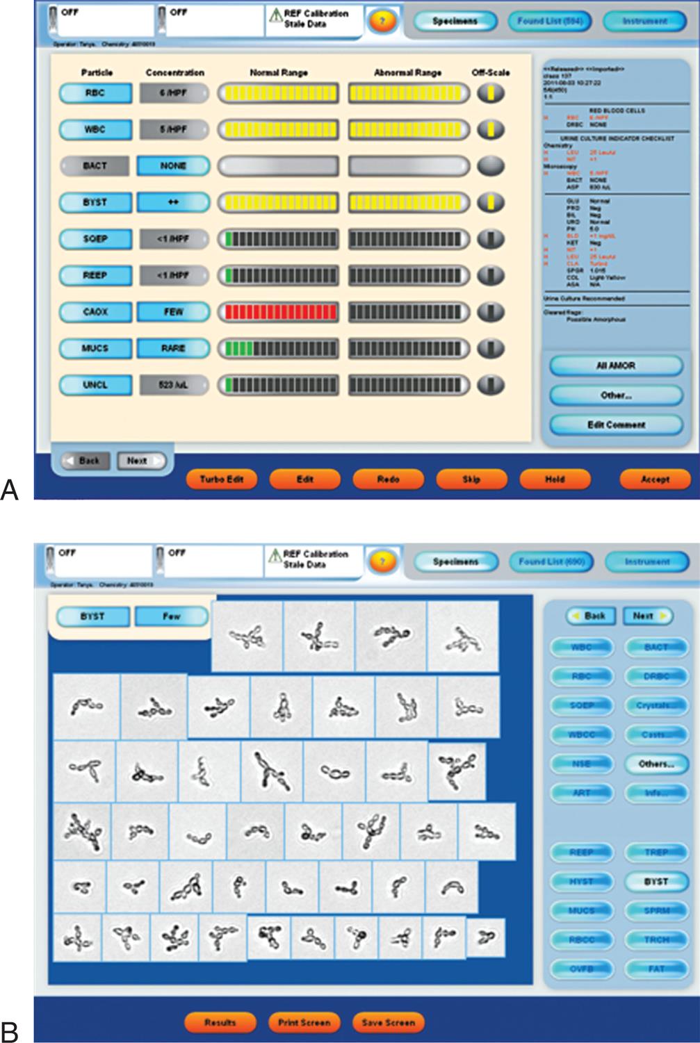 16: Automation of Urine and Body Fluid Analysis