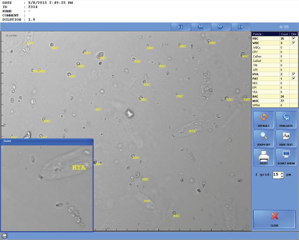 16: Automation of Urine and Body Fluid Analysis