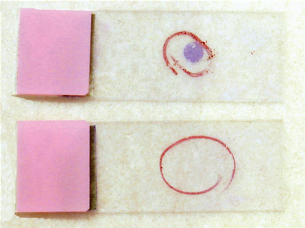 17: Body Fluid Analysis:Manual Hemacytometer Counts and Differential ...