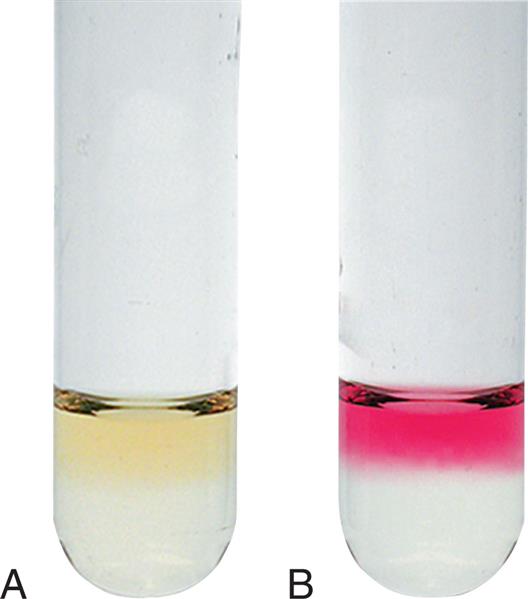 APPENDIX A: Reagent Strip Color Charts