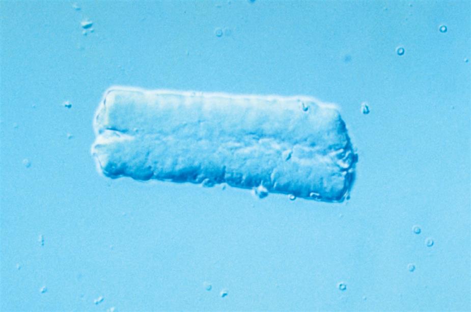 7: Routine Urinalysis–the Microscopic Exam of Urine Sediment