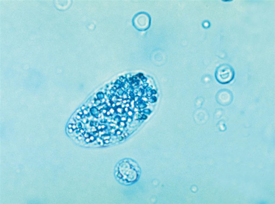 7: Routine Urinalysis–the Microscopic Exam of Urine Sediment