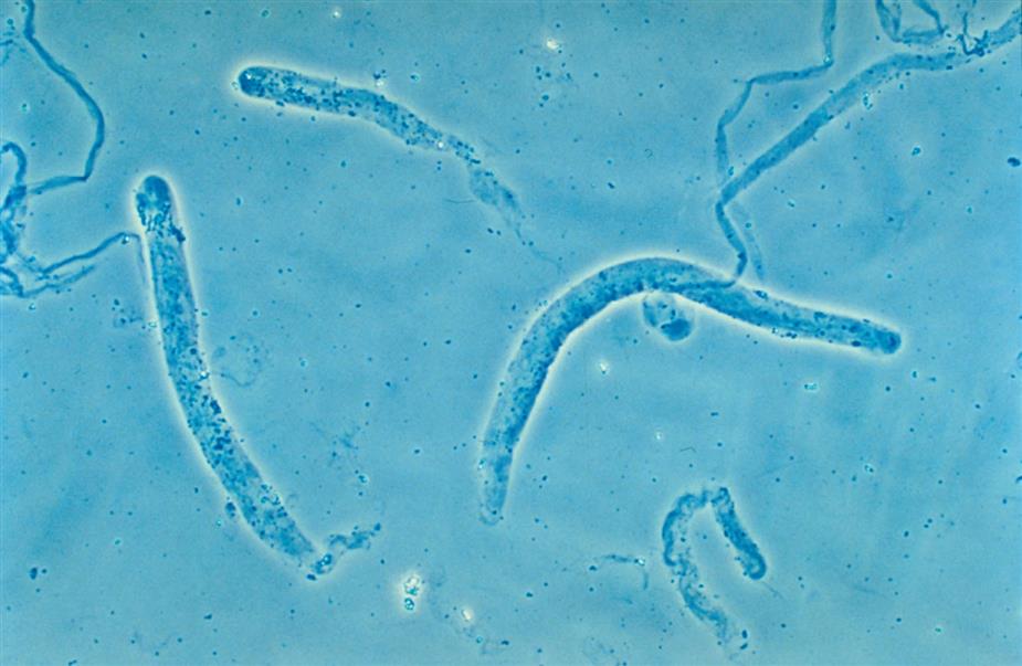 7: Routine Urinalysis–the Microscopic Exam of Urine Sediment