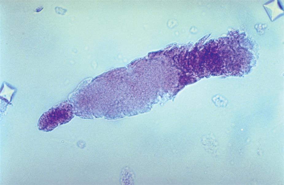 7: Routine Urinalysis–the Microscopic Exam of Urine Sediment